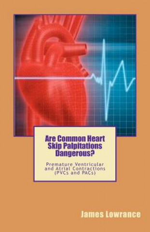 Are Common Heart Skip Palpitations Dangerous?: Premature Ventricular ...