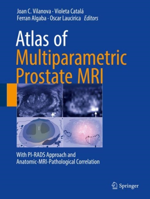 Atlas of Multiparametric Prostate MRI | E-könyv adobe epub drm ...